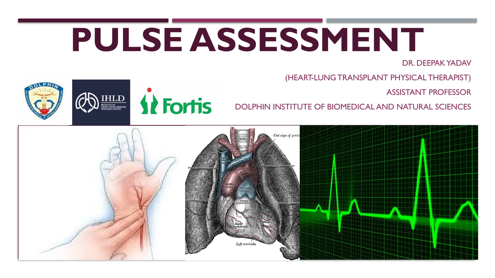 Pulse assessment by Dr. Deepak Yadav.pptx