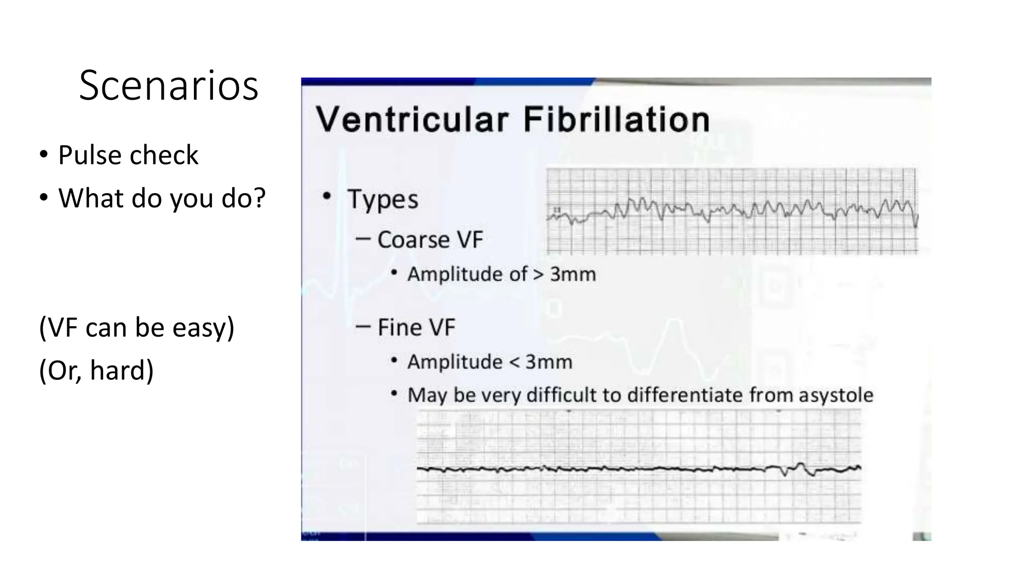 Pulse Check Decisions - RRT and Code Blue Workshop | PPT