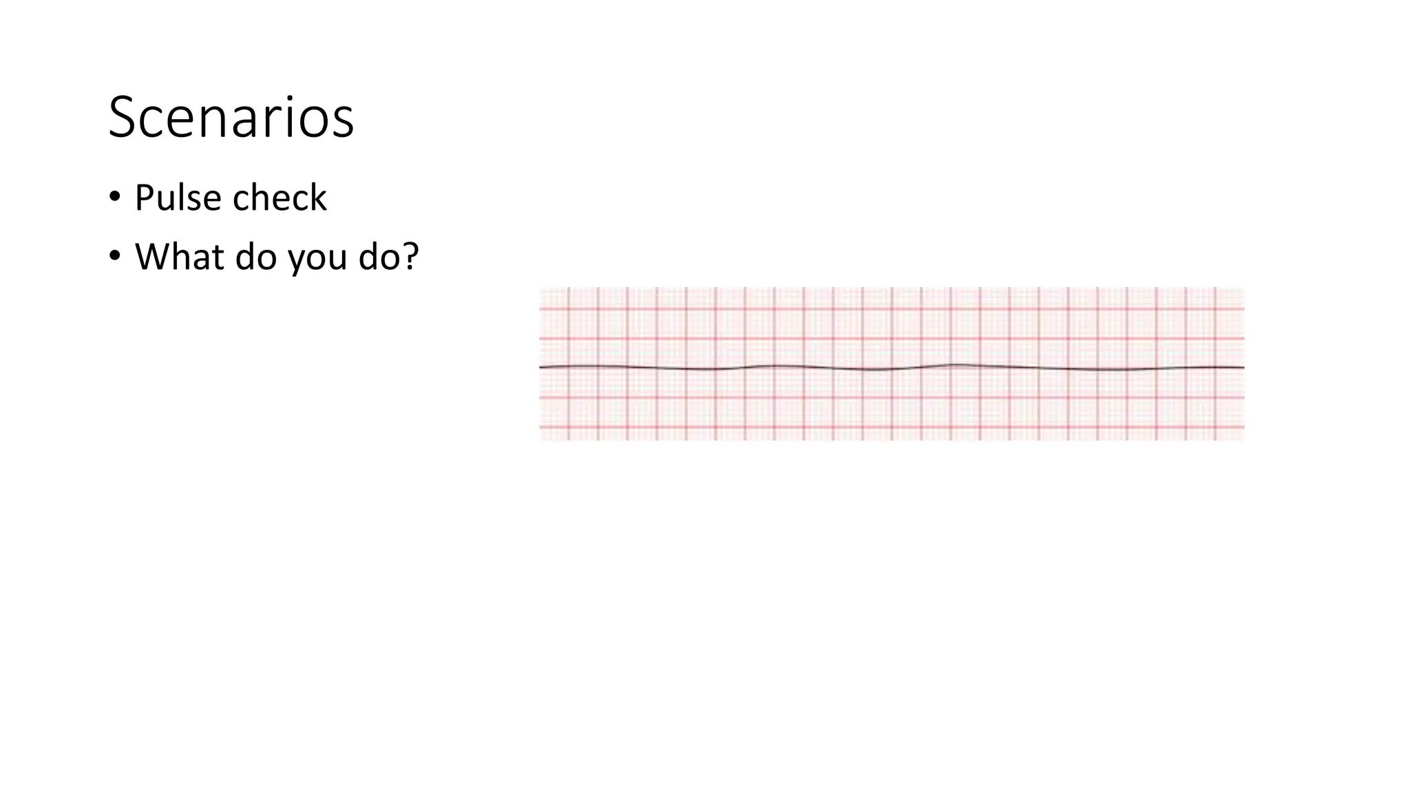 Pulse Check Decisions - RRT and Code Blue Workshop | PPT