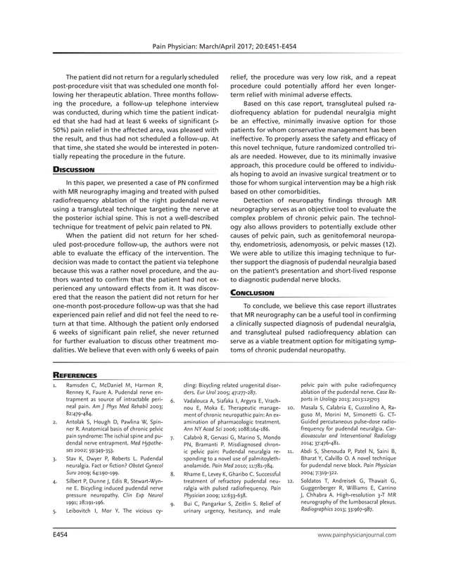 Pulsed radiofrequency ablation of pudendal nerve for treatment of a case of refractory pelvic ...
