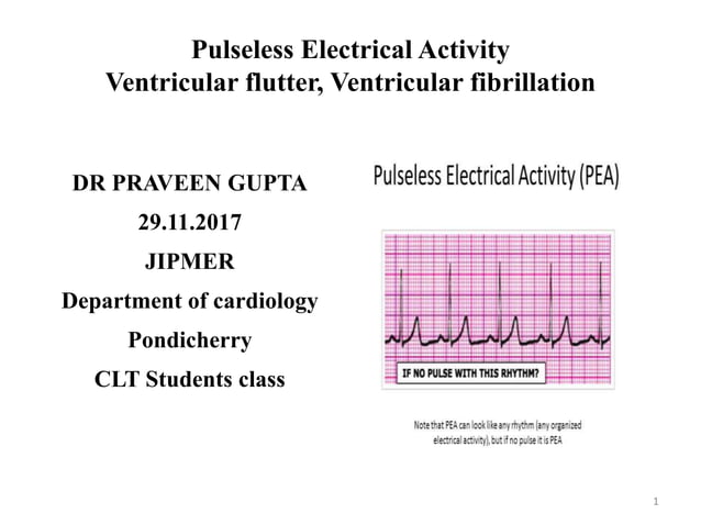 Pulseless electrical activity, Ventricular flutter, Ventricular ...