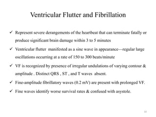 Pulseless electrical activity, Ventricular flutter, Ventricular ...