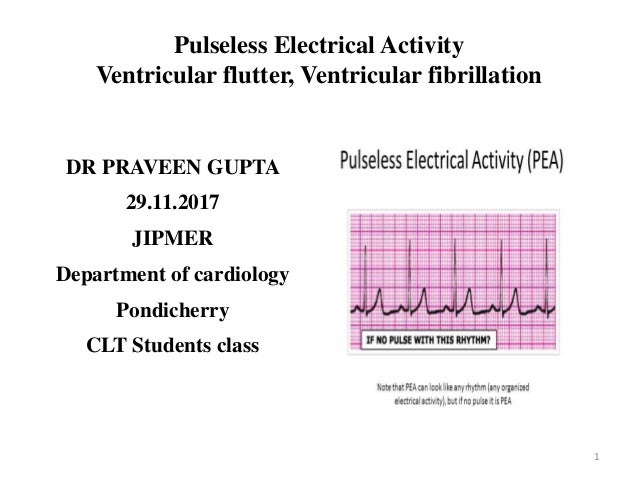 Icd 10 pulseless electrical activity - iesseka