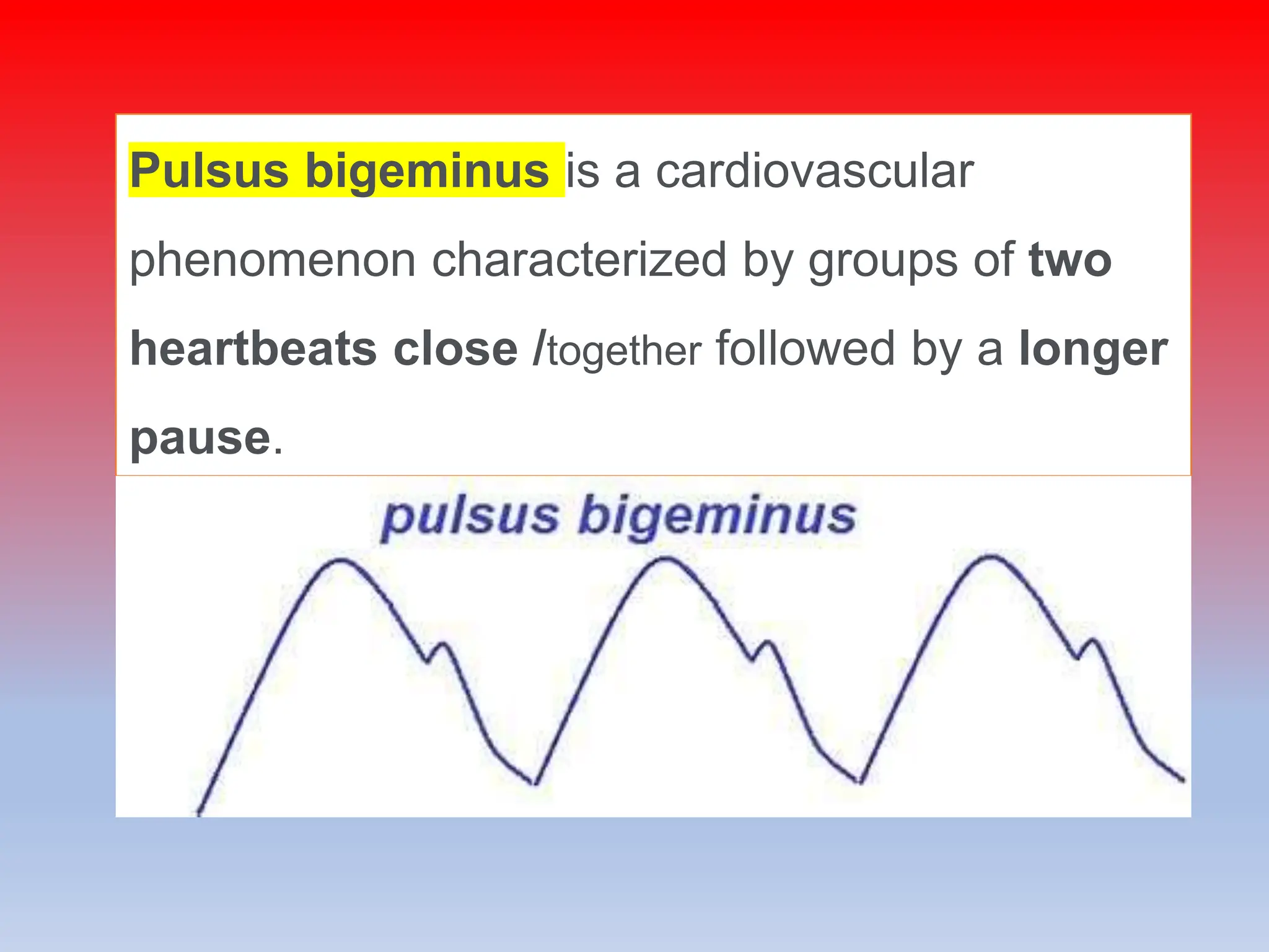 PULSE OR HEART RATE,TYPES OF PULSE ,FACTORS AFFECTING AND REGULATION .pptx