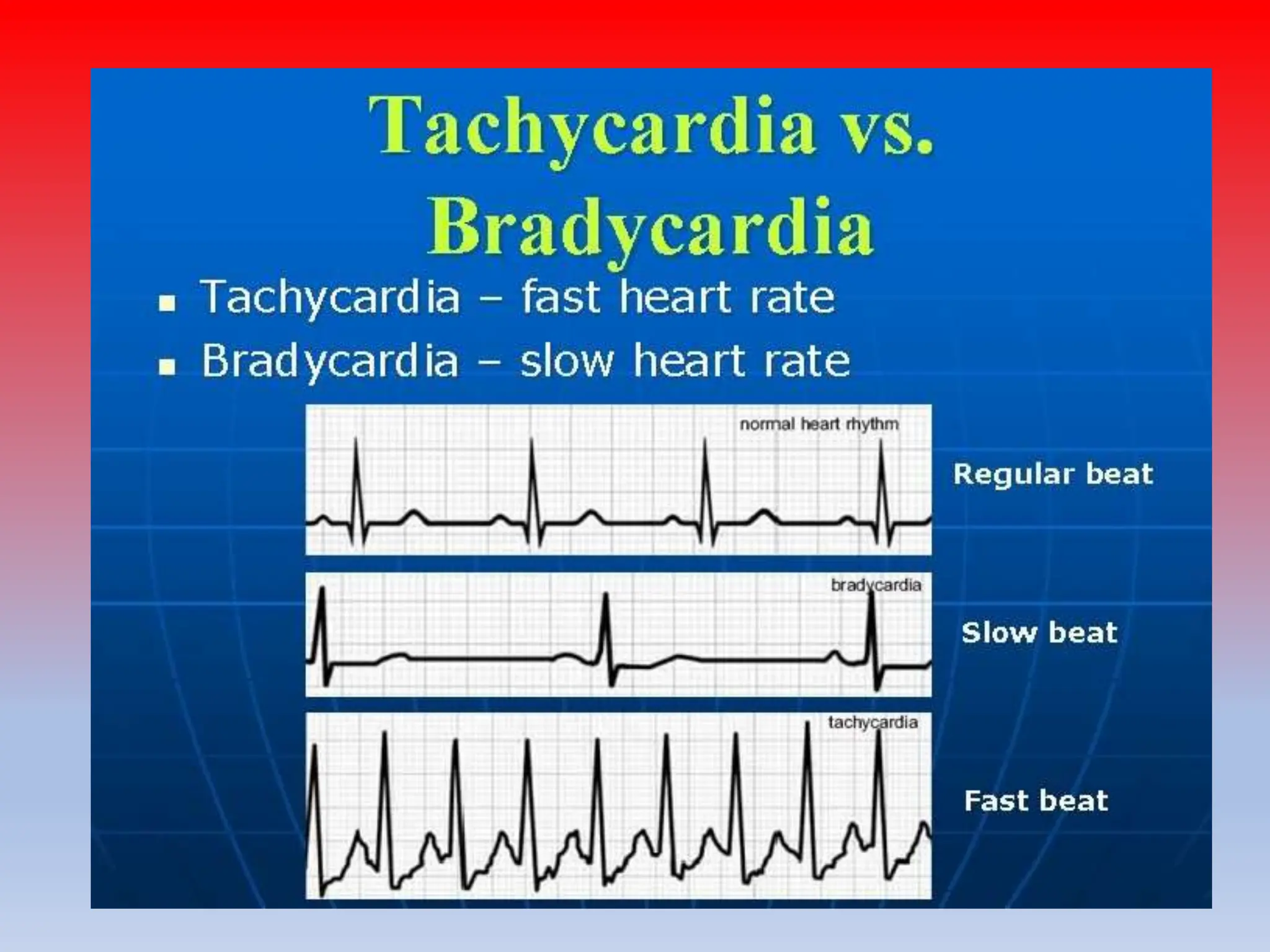 PULSE OR HEART RATE,TYPES OF PULSE ,FACTORS AFFECTING AND REGULATION .pptx