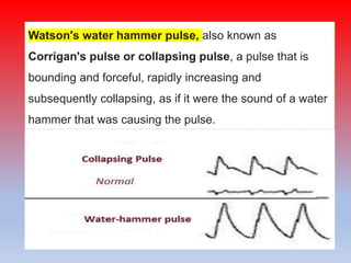 PULSE OR HEART RATE,TYPES OF PULSE ,FACTORS AFFECTING AND REGULATION .pptx