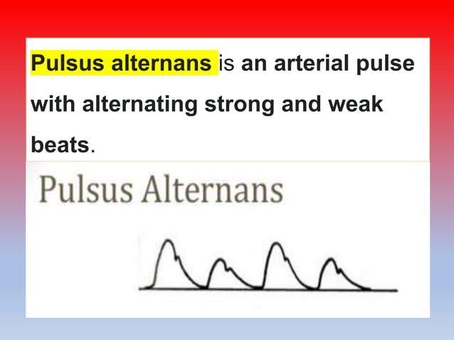 PULSE OR HEART RATE,TYPES OF PULSE ,FACTORS AFFECTING AND REGULATION ...