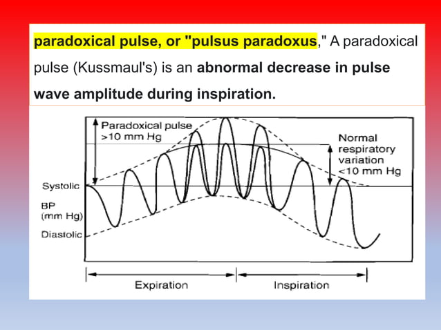 PULSE OR HEART RATE,TYPES OF PULSE ,FACTORS AFFECTING AND REGULATION ...