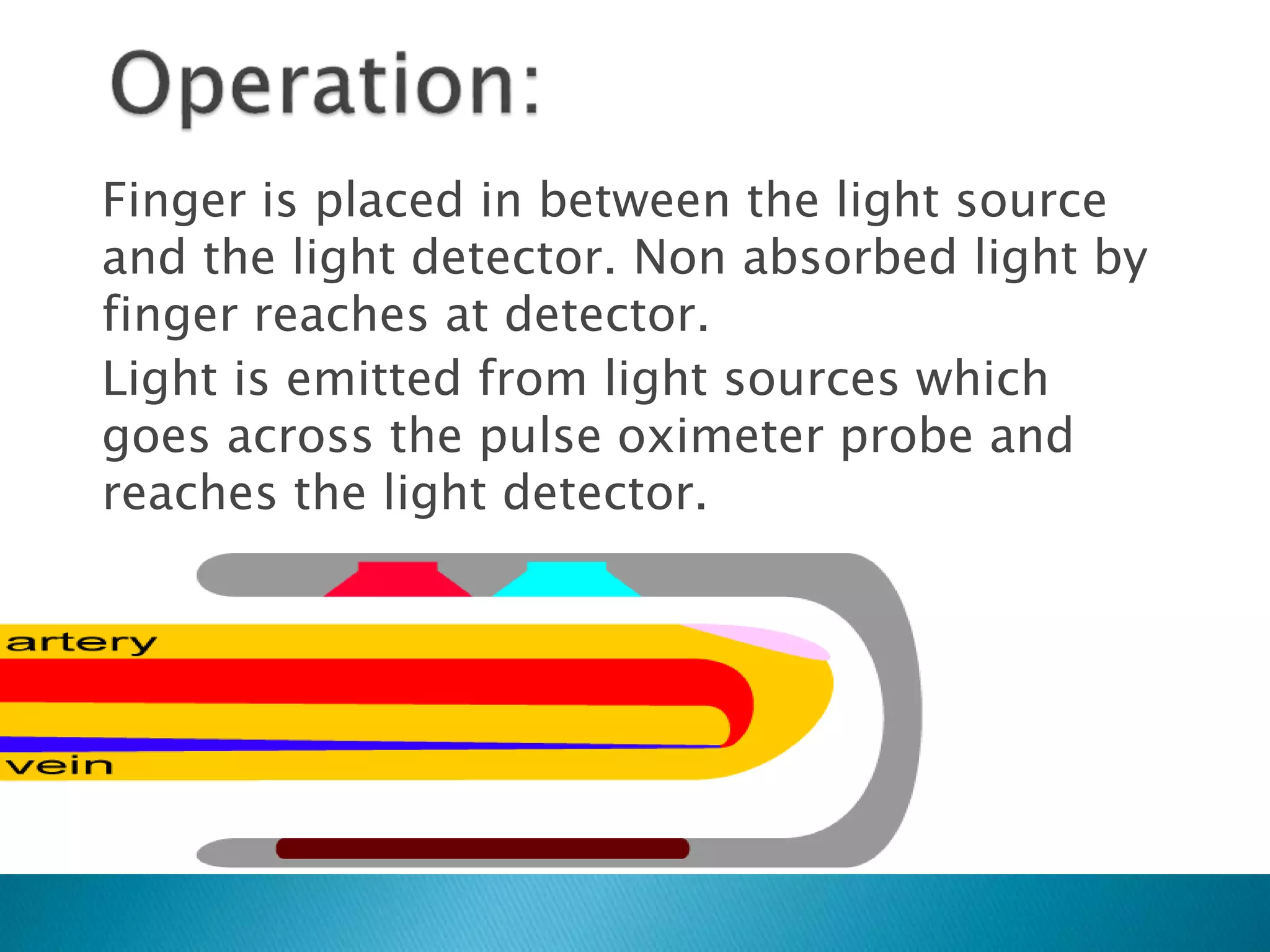 Pulse oximeter | PPTX