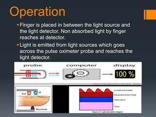 Pulse oximeter | PPTX