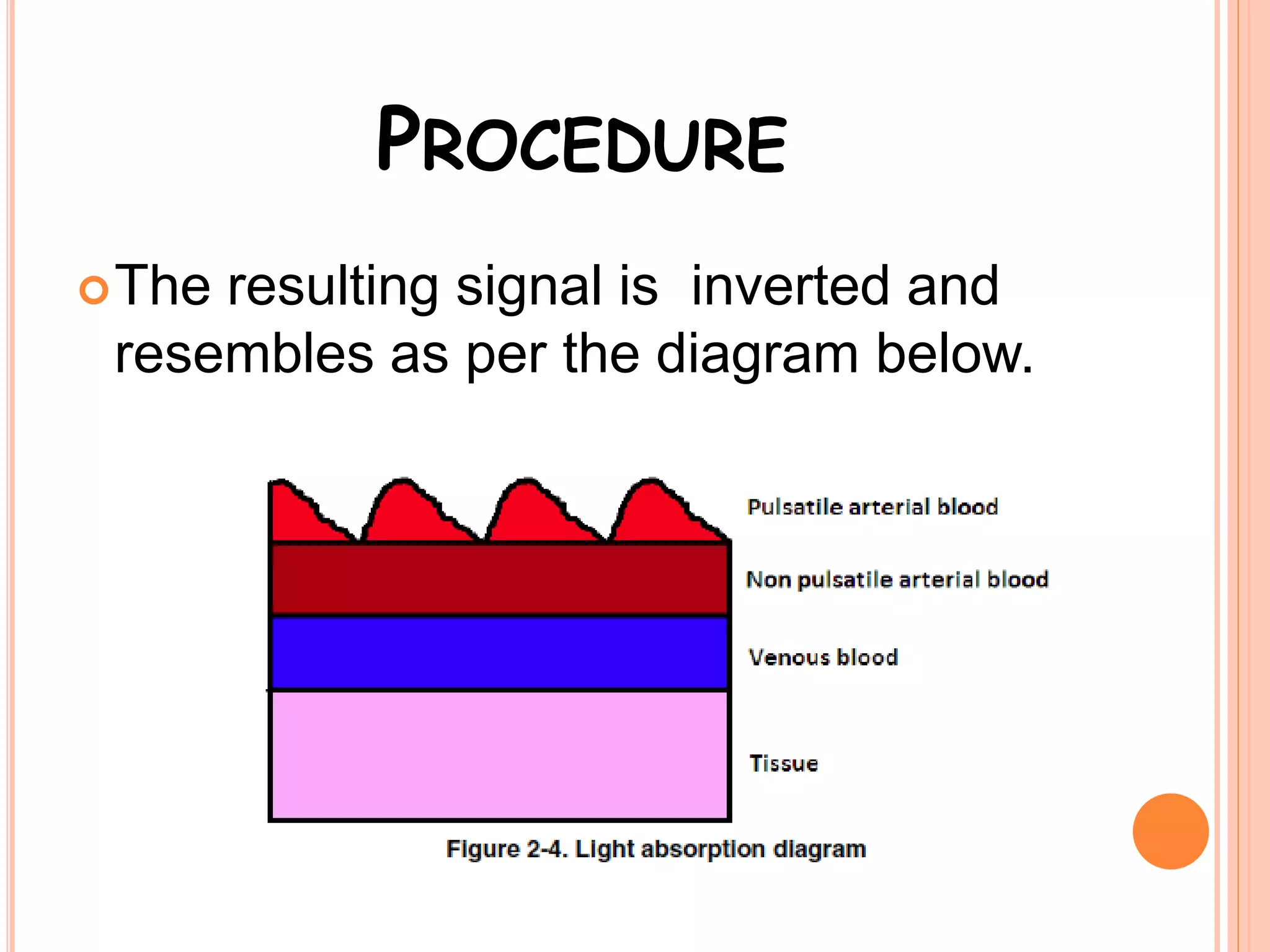 Pulse oximetry. | PPTX