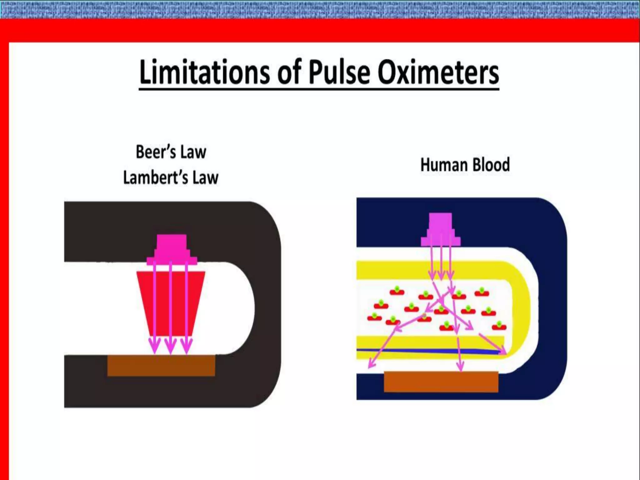 Pulse oximetry. | PPTX