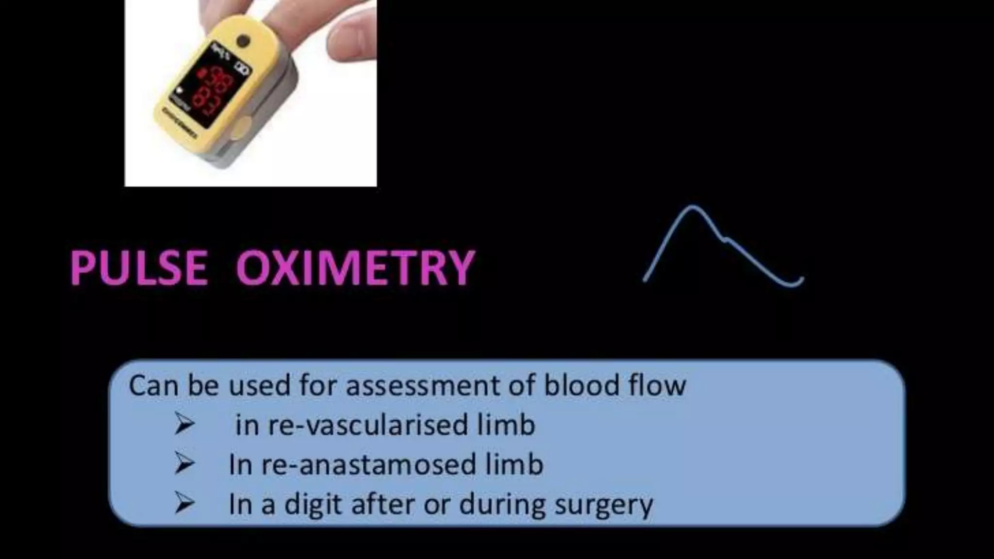 Pulse oximeter | PPTX