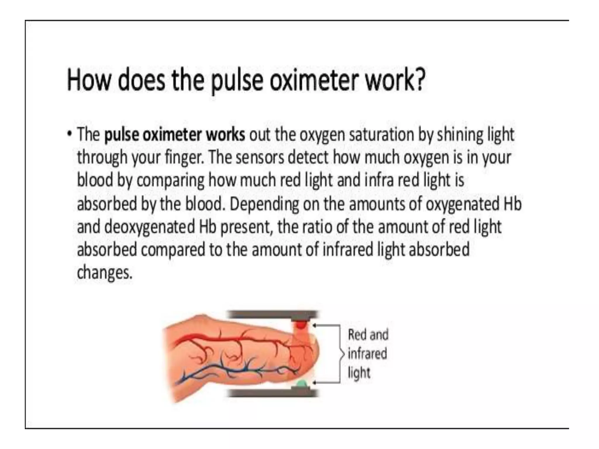 PULSE OXIMETRY | PPTX