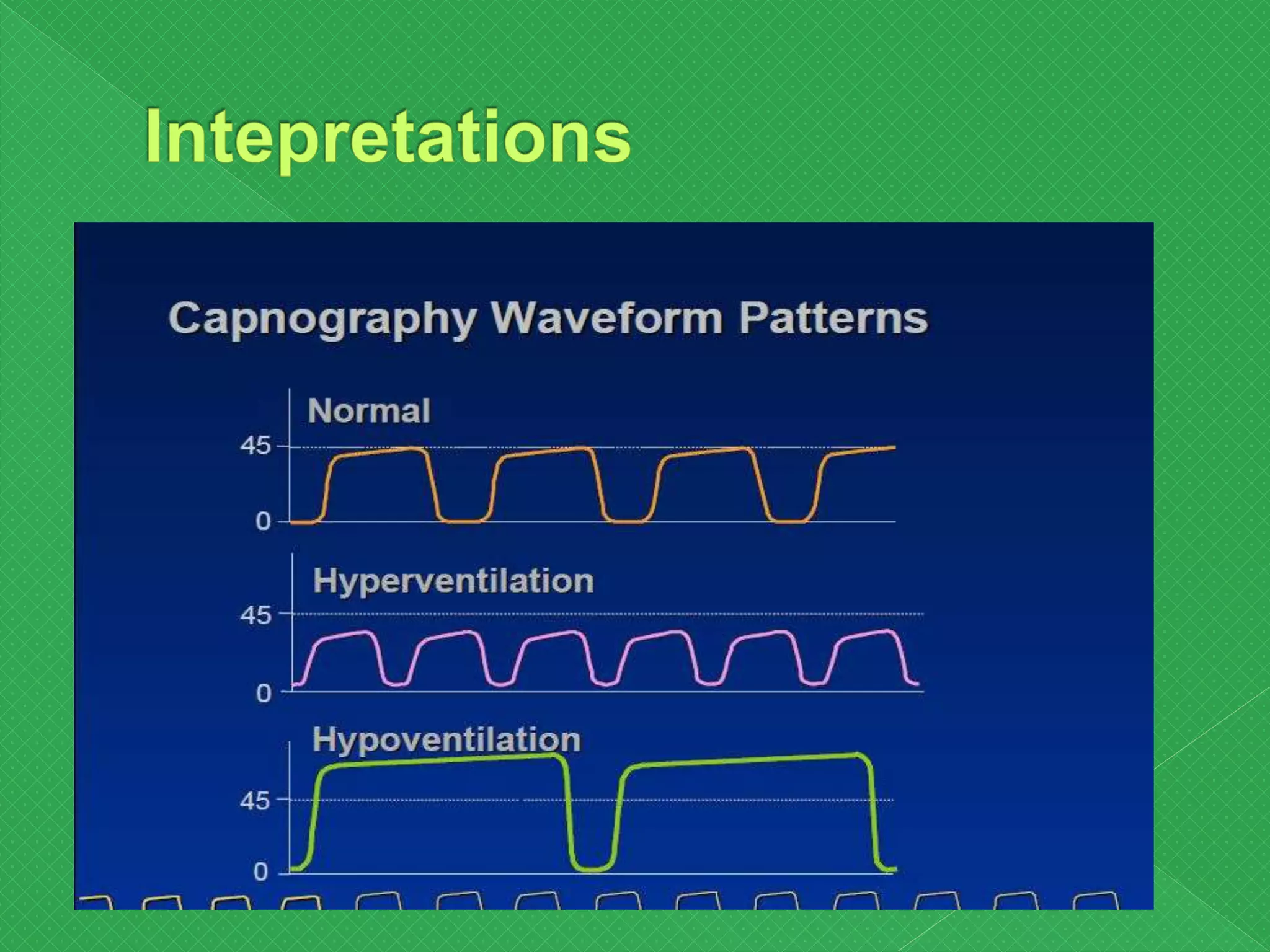 Pulse oximetry & capnography | PPT