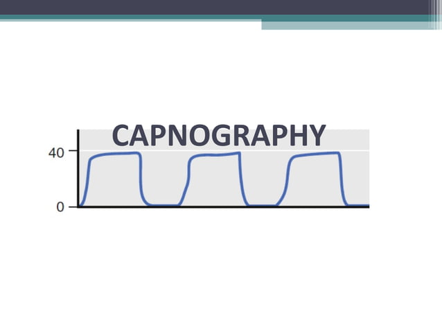 Pulse oximetry capnography | PPT