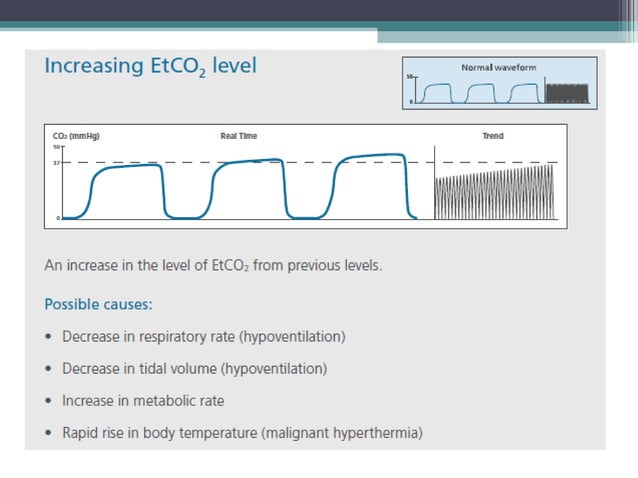 Pulse oximetry capnography