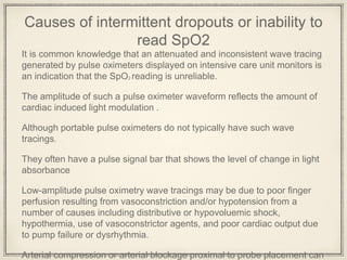 Pulse oximetry journal | PPT