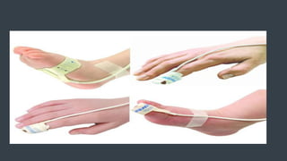 PULSE OXIMETRY its principle and its components | PPTX