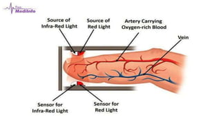 PULSE OXIMETRY .pptx