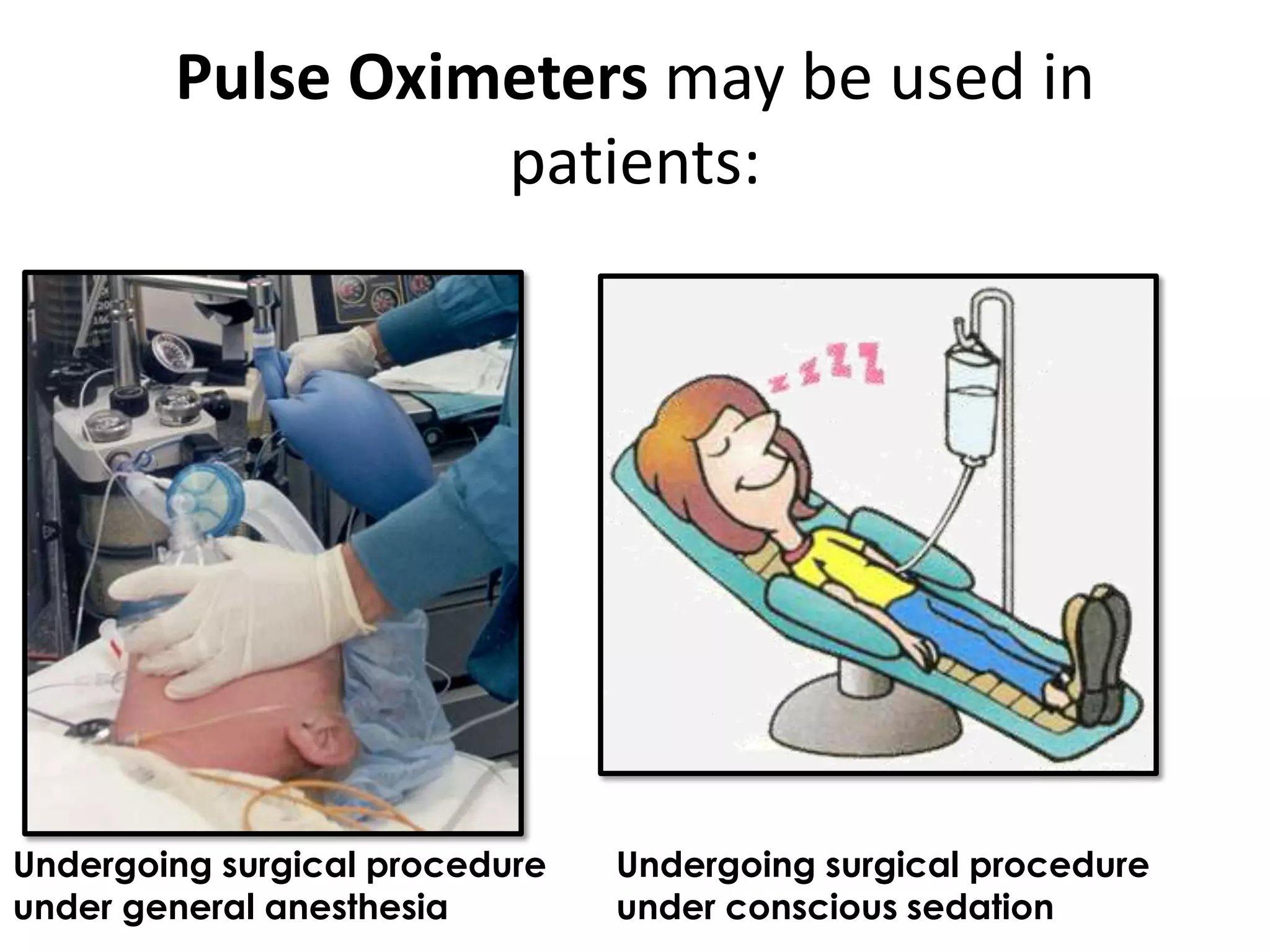 Pulse oximetry slidefinal abc | PPTX