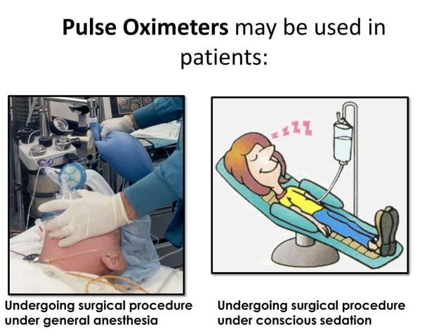 Pulse oximetry slidefinal abc | PPT