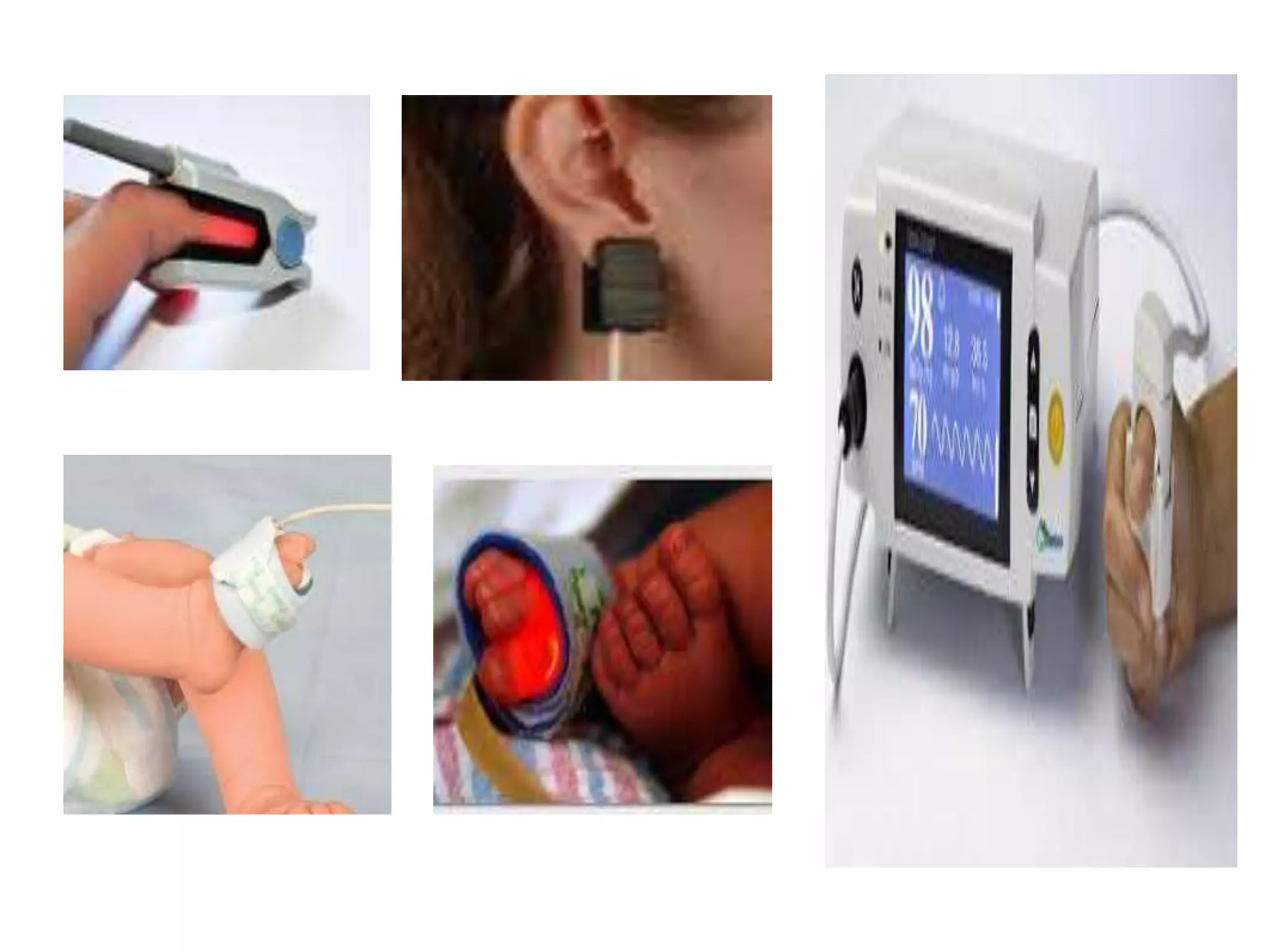 Pulse oxymetry | PPTX