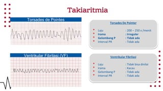 Aritmia | PPTX