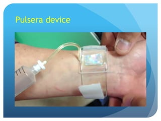 Pancholy SB - AIMRADIAL 2013 - Pulsera hemostasis | PPT