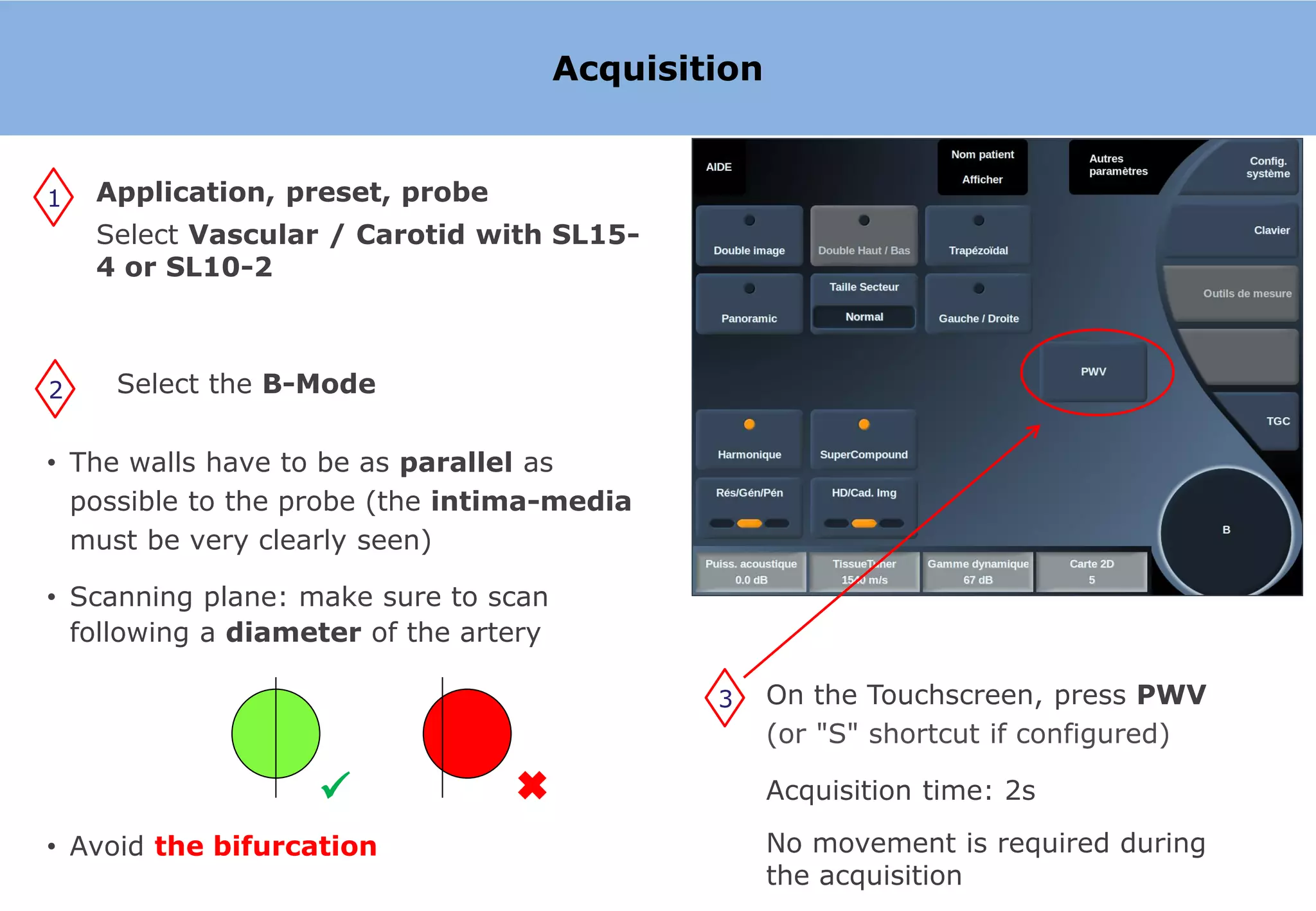 Pulse wave velocity ssid02688 03 | PDF