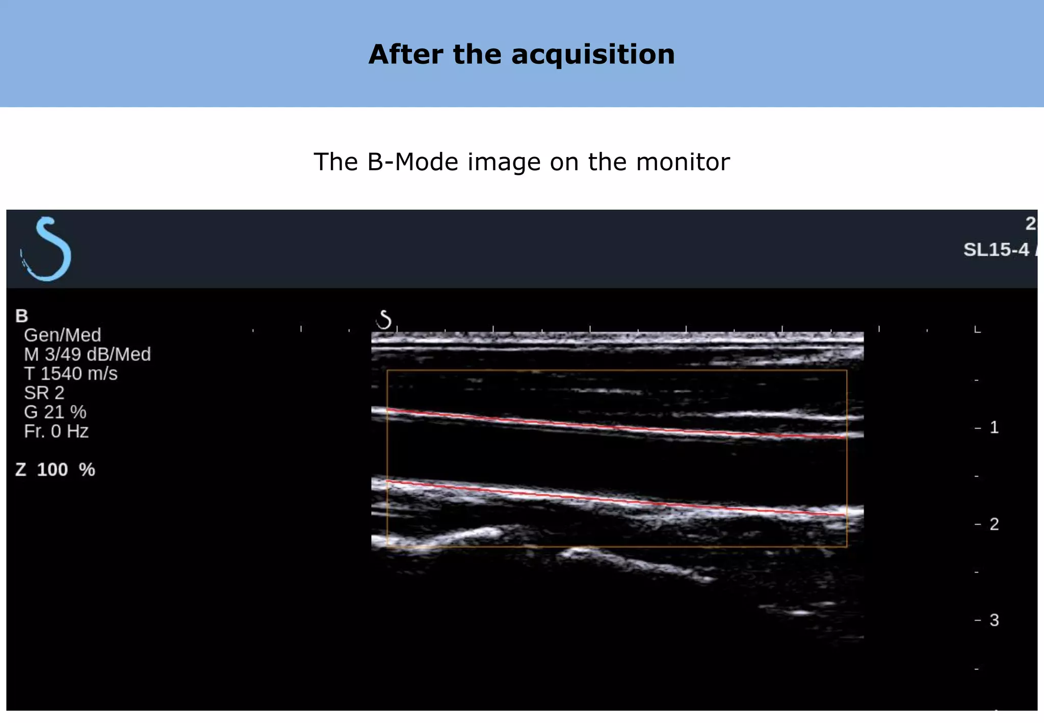 Pulse wave velocity ssid02688 03 | PDF