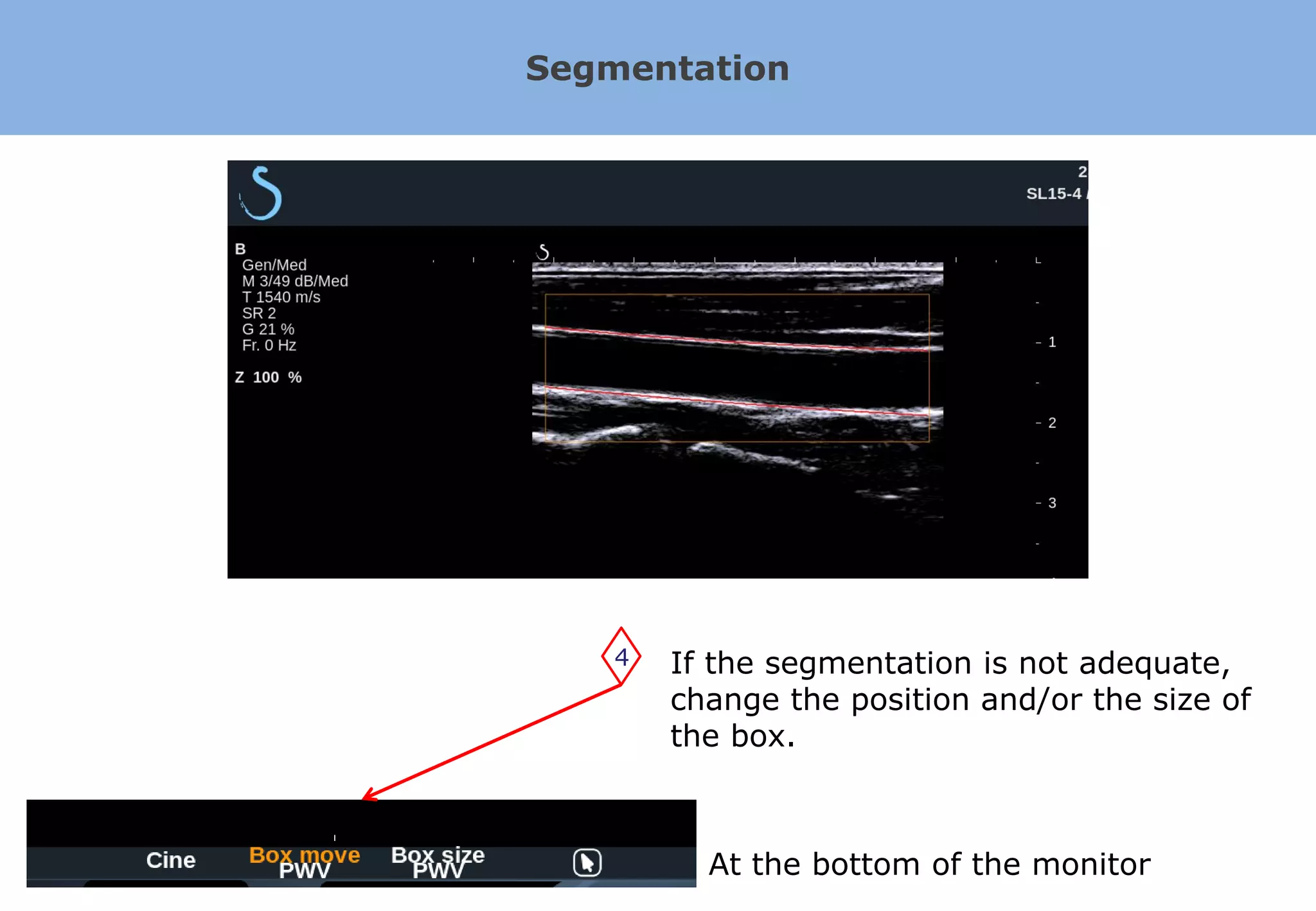 Pulse wave velocity ssid02688 03 | PDF