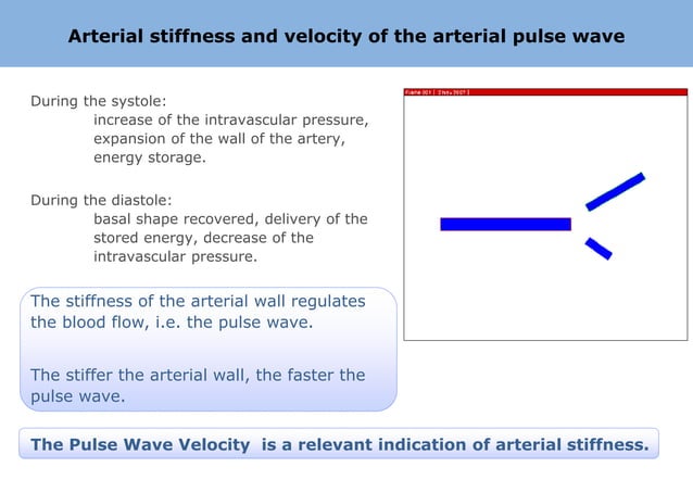 Pulse wave velocity ssid02688 03 | PDF | Heart and Cardiovascular Diseases | Diseases and Conditions