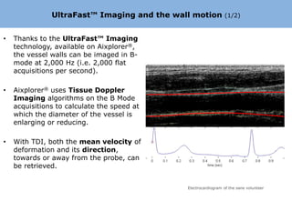 Pulse wave velocity ssid02688 03 | PDF