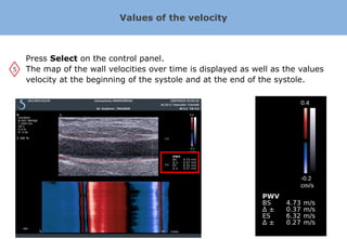 Pulse wave velocity ssid02688 03 | PDF