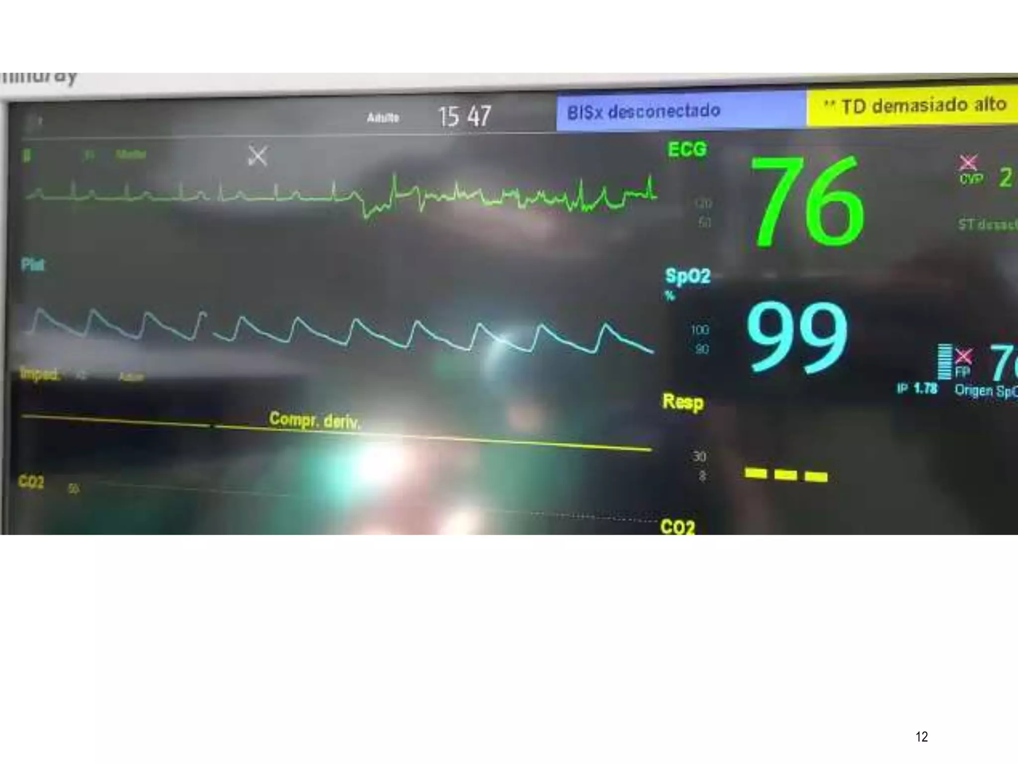 pulsioximetria , CAPNOGRAFÍA y CAPNOMETRÍA.pptx