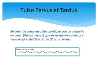 Tipos de pulso | PPTX