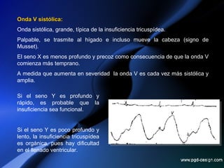 Pulso Venoso Yugular | PPT