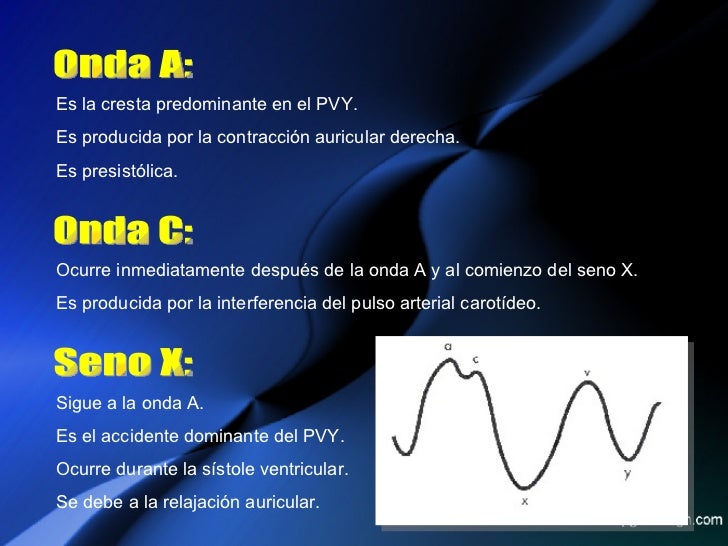 Pulso Venoso Yugular