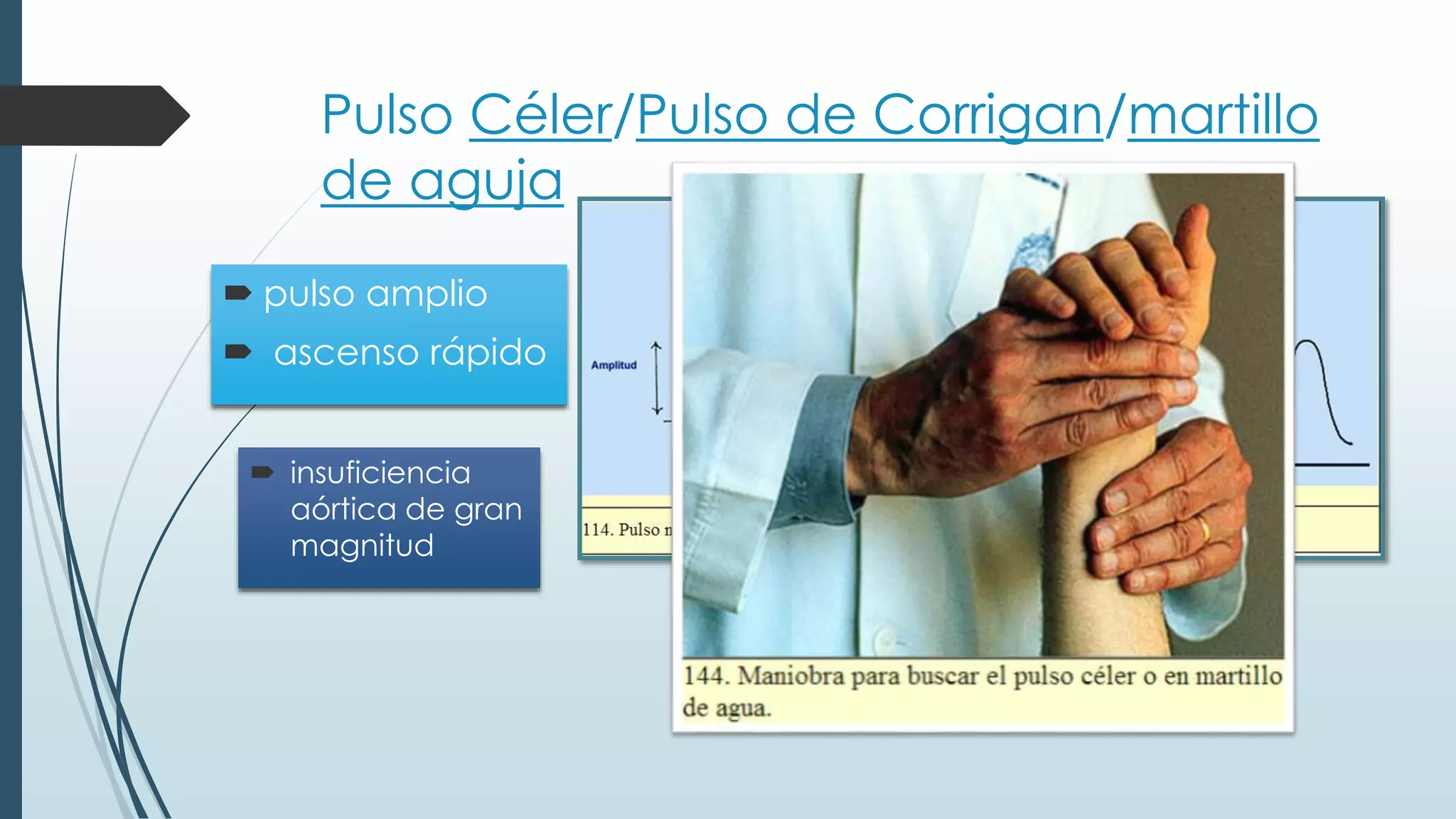 Pulso arterial | PPTX
