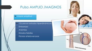 Pulso arterial | PPTX