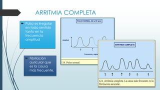 Pulso arterial | PPTX