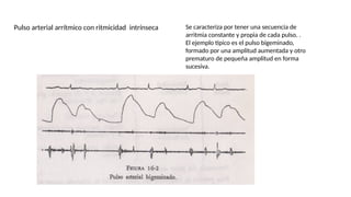 Pulso Arterial- Dra. Acosta cardiólogia.pptx