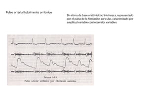 Pulso Arterial- Dra. Acosta cardiólogia.pptx