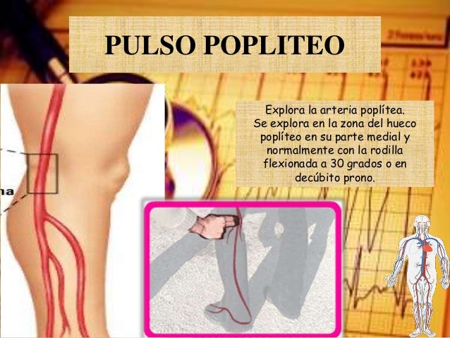 Pulsos arteriales