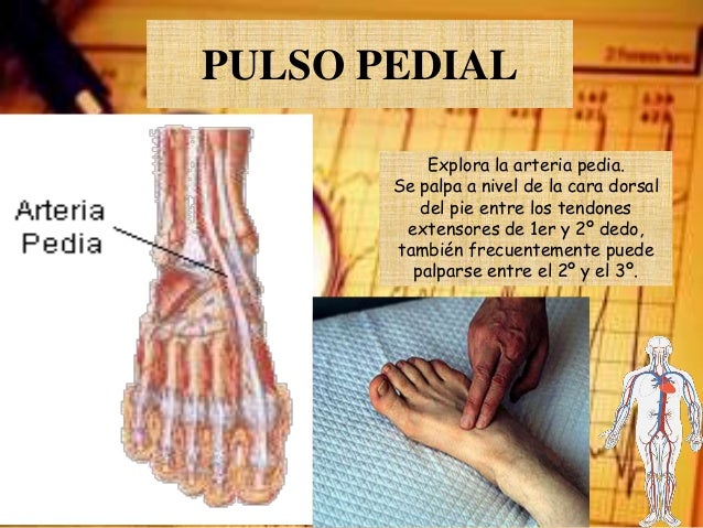 Pulsos arteriales