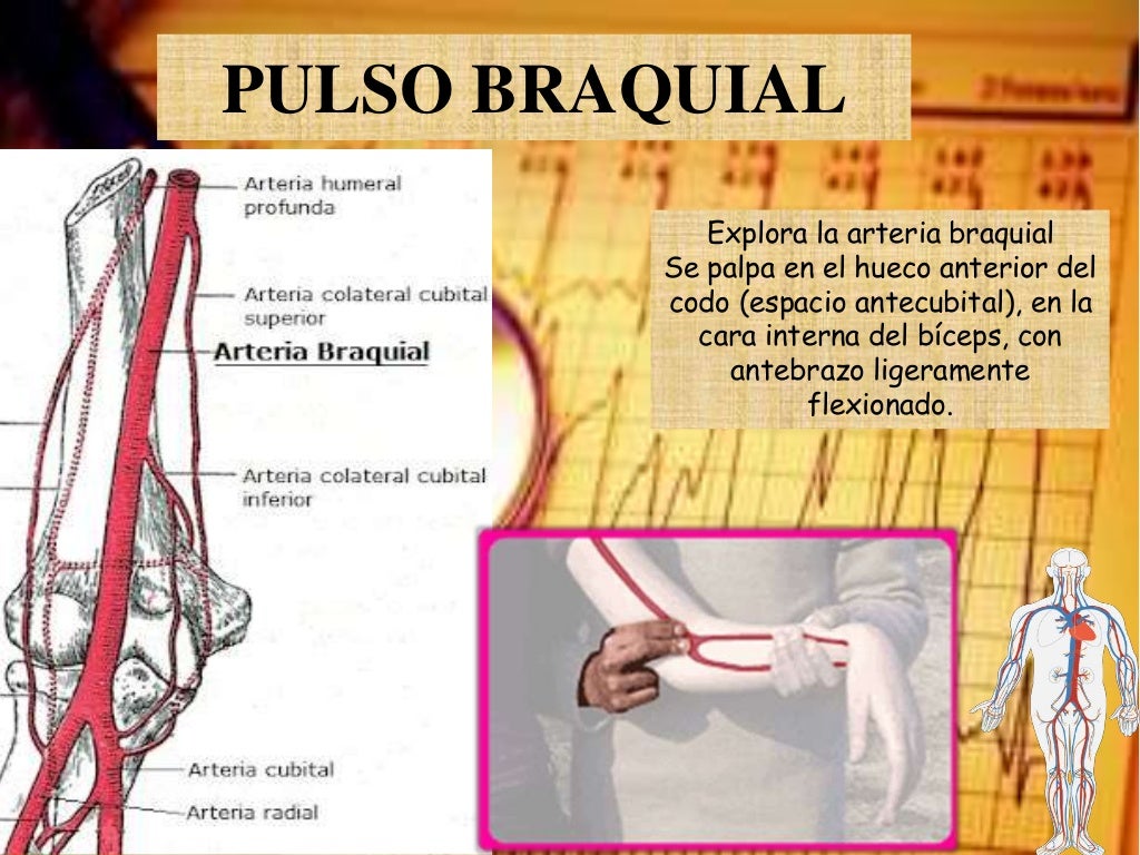 Pulsos arteriales