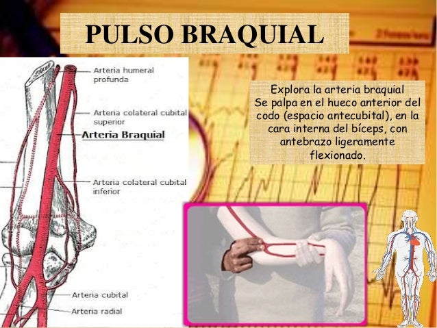 Pulsos arteriales