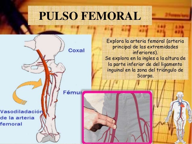 Pulsos arteriales