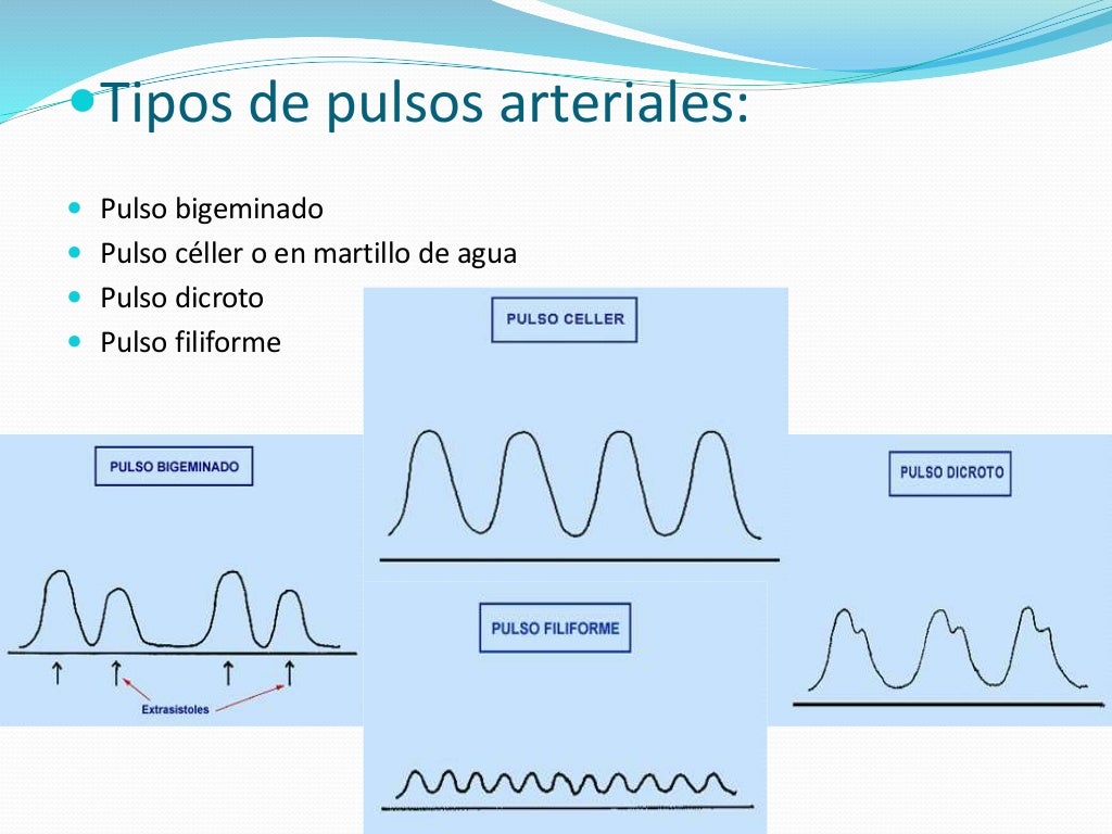 Pulso Cheio E Filiforme - LIBRAIN